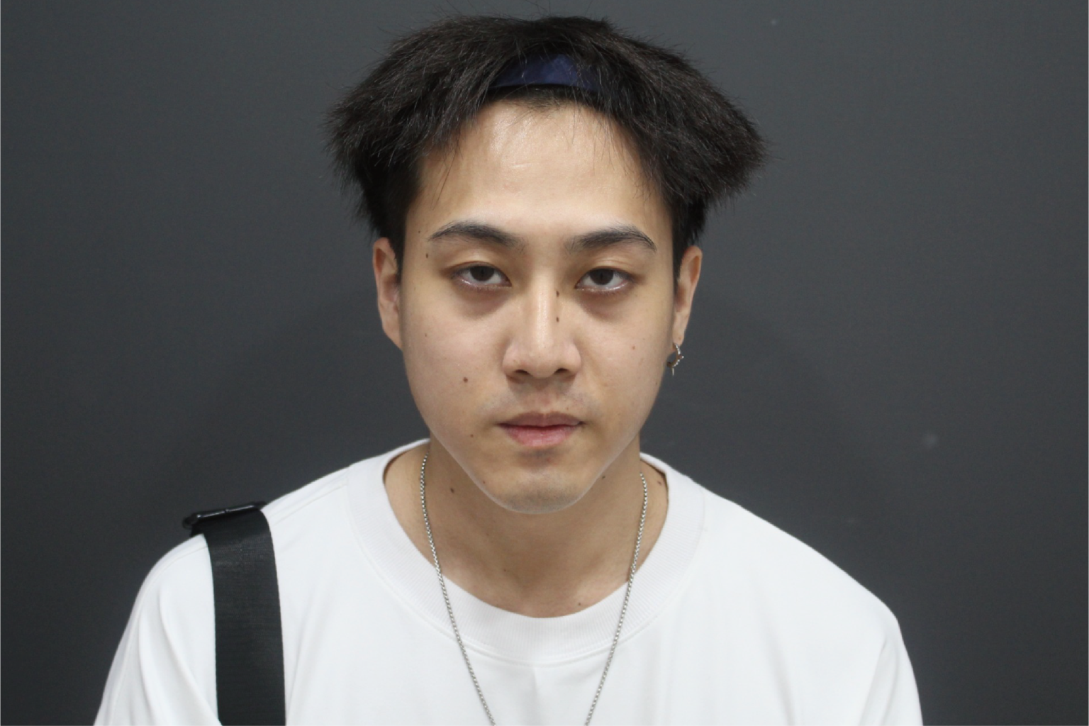 台中熊貓針推薦醫美品牌，助妳改善黑眼圈問題 - 禾伊美學診所