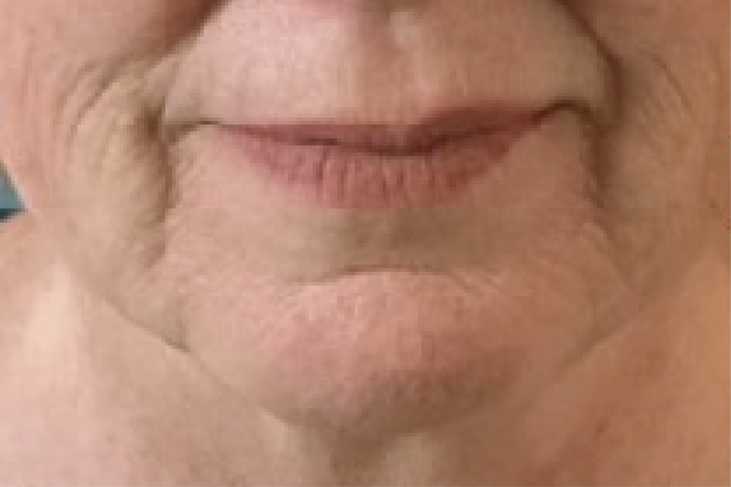 台中海芙音波推薦專業的醫美團隊『禾伊美學診所』